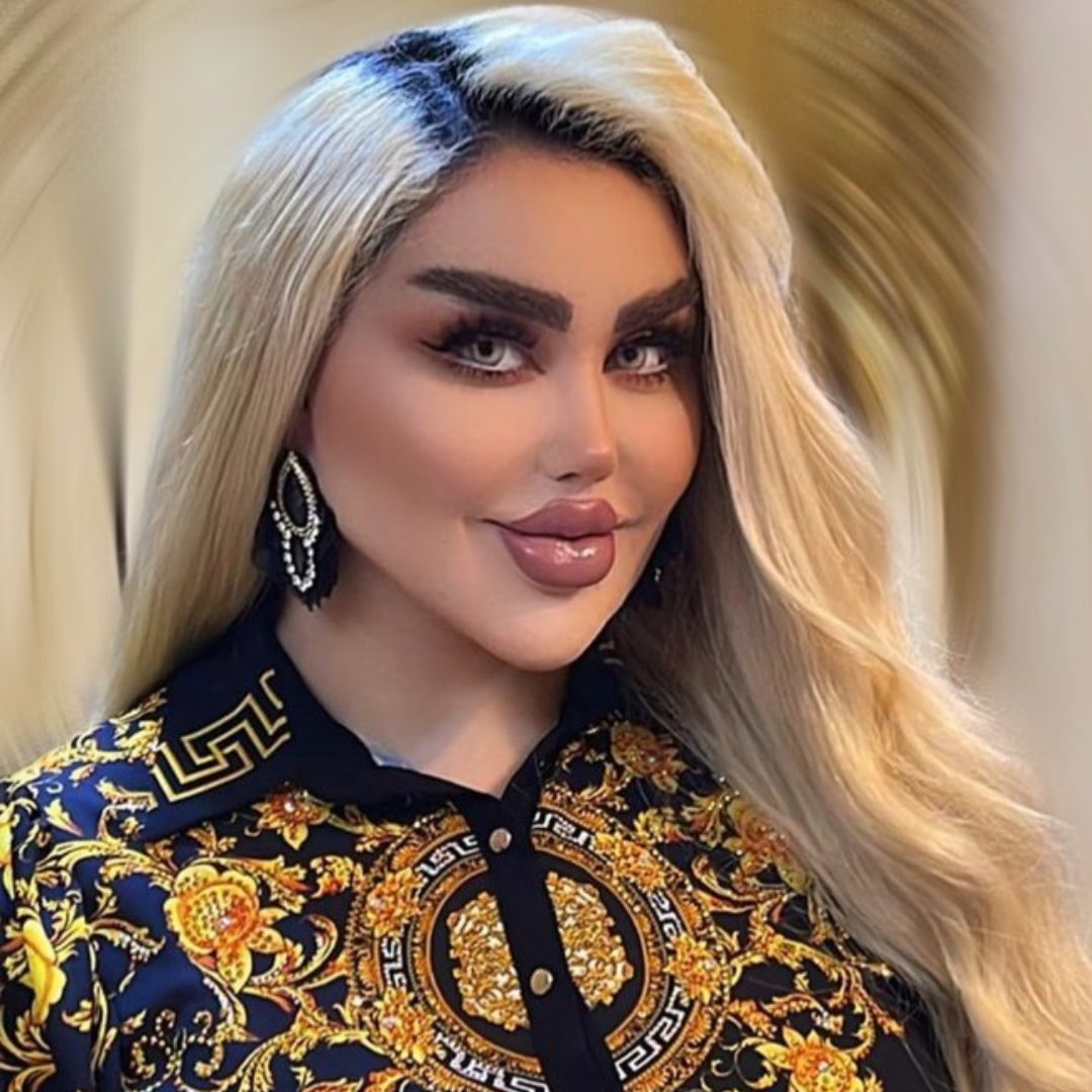 “Iraqi Barbie” Dalia Naeem: 43 Procedures, Viral Fame, and the Internet ...